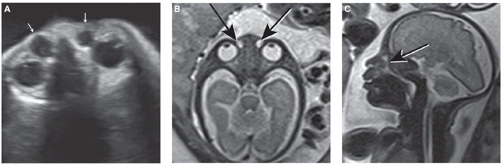 Face | Radiology Key