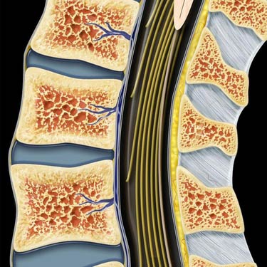 Renal Osteodystrophy | Radiology Key