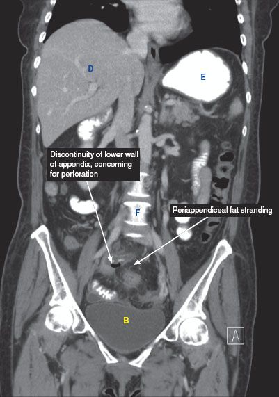 Appendix | Radiology Key