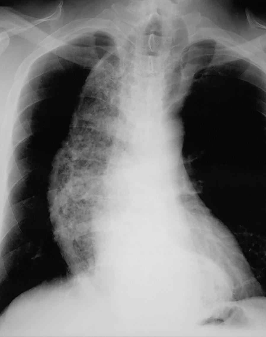 Pharynx and Esophagus | Radiology Key
