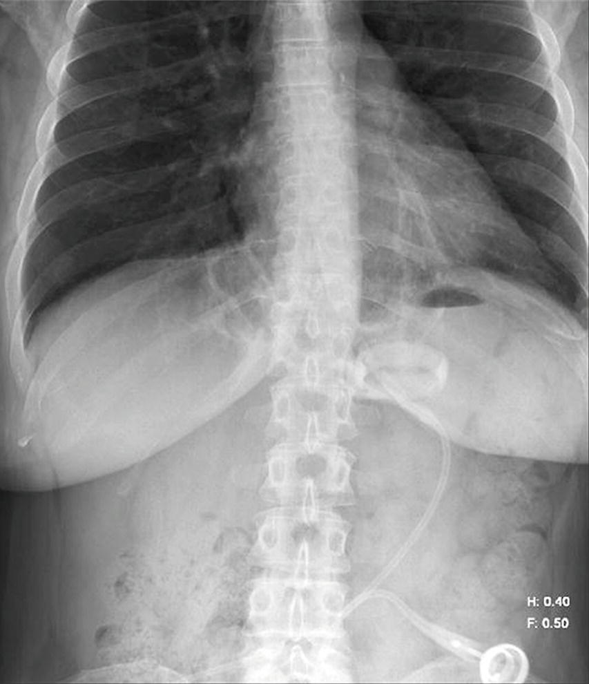 Stomach | Radiology Key