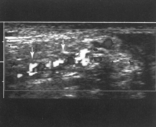Male Pelvis Scanning Protocol for the Prostate Gland, Scrotum, and ...