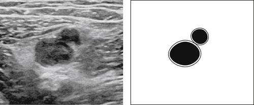 Peripheral Arterial and Venous Duplex Scanning Protocols | Radiology Key