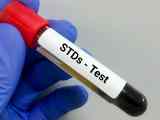 Rapid Std Testing Your Essential Guide To Must Have Tests
