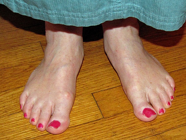 Gidion’s Knot | RegenAxe