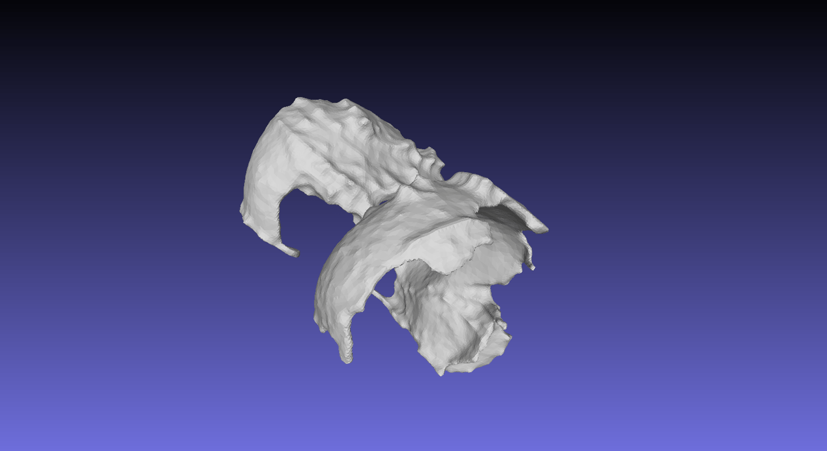 Database of Patient-specific Anatomical Models for Condyle Lesions ...