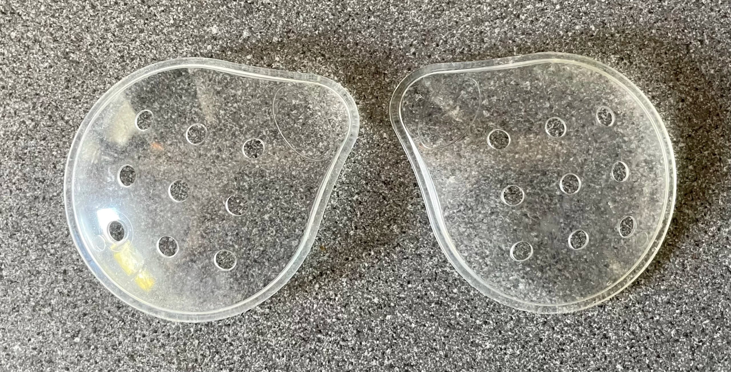 Post-op cataract removal and lens replacement surgery