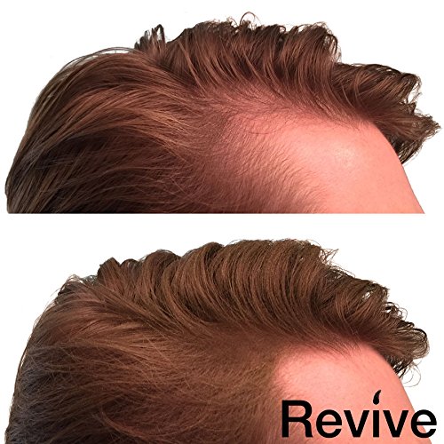Shop Revive Instant Hair Loss Solution and Hair Thickener