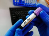 What The Prostate Health Index Score Is Why It Matters