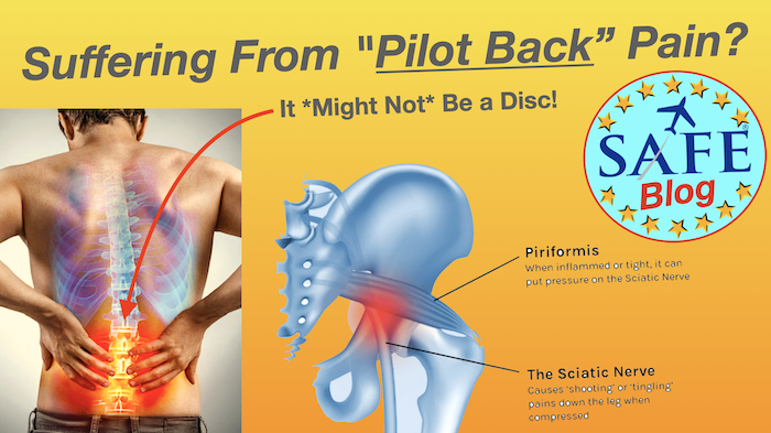 Fix Your "Pilot Back Pain!" - Aviation Ideas and Discussion!