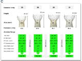 Corevalve Sizing