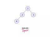 Binary Tree Implementation In Java Scaler Topics