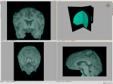 Seg3d Tutorial