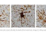Zombie Genes Research Shows Some Genes Come To Life In The Brain