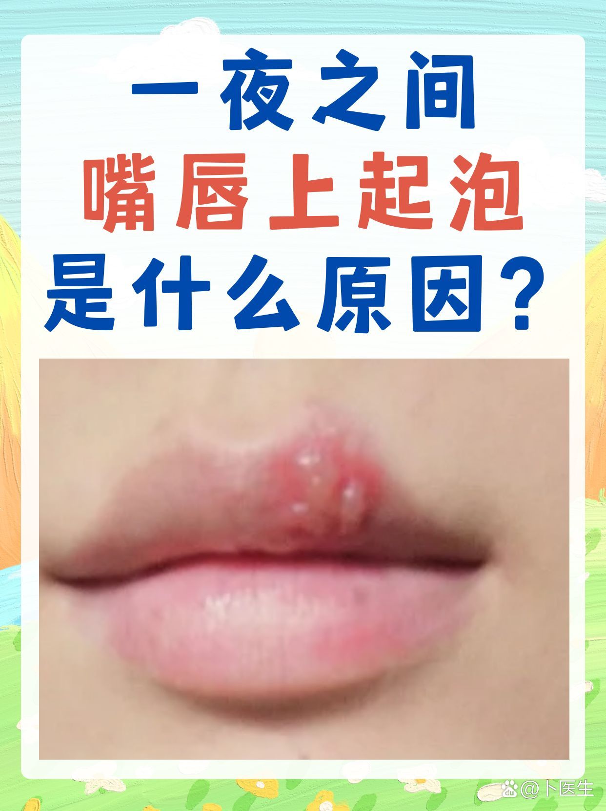 一夜之间嘴唇上起泡是什么原因