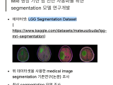 Mri 영상 기반 암 진단 자동화 연구 Seoharu Github Io