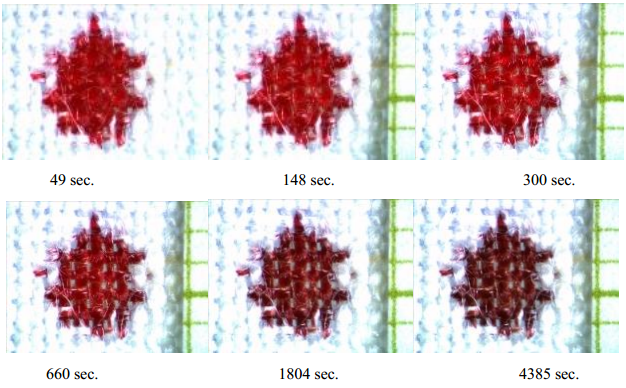 Unique Blood Marks Explained? – Shroud of Turin: Should You Believe It ...