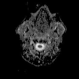 MRI images and animations | snarfed.org