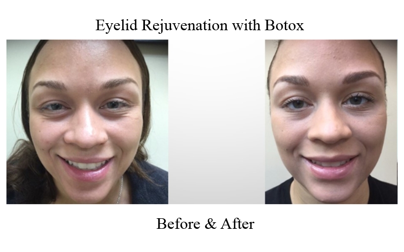 Cosmetic Dermatology Services - MD Dermatology Mohs Surgery Cosmetic ...