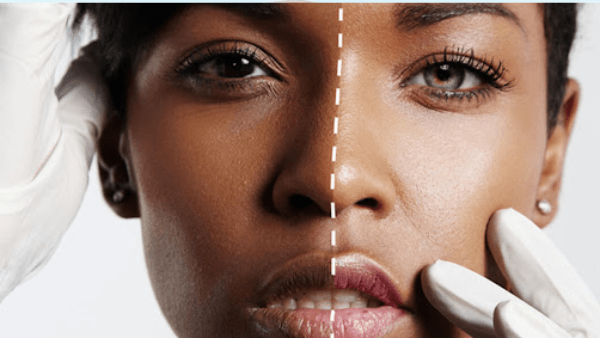 The Black Skin Colour Is Healthy And Very Beautiful; Do Not Bleach It ...