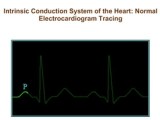 Cardiac Conduction System And Understanding Ecg Animation