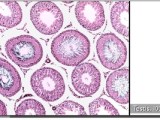 Full Video Male Reproductive System Human Anatomy Kenhub Study
