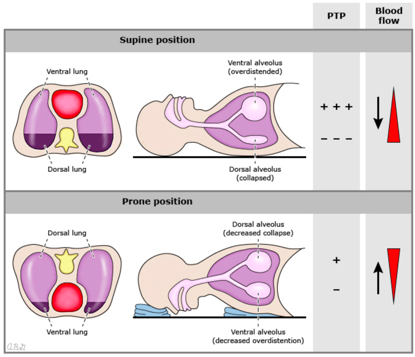 Prone-Positioning – Multi Trauma Critical Care Resources