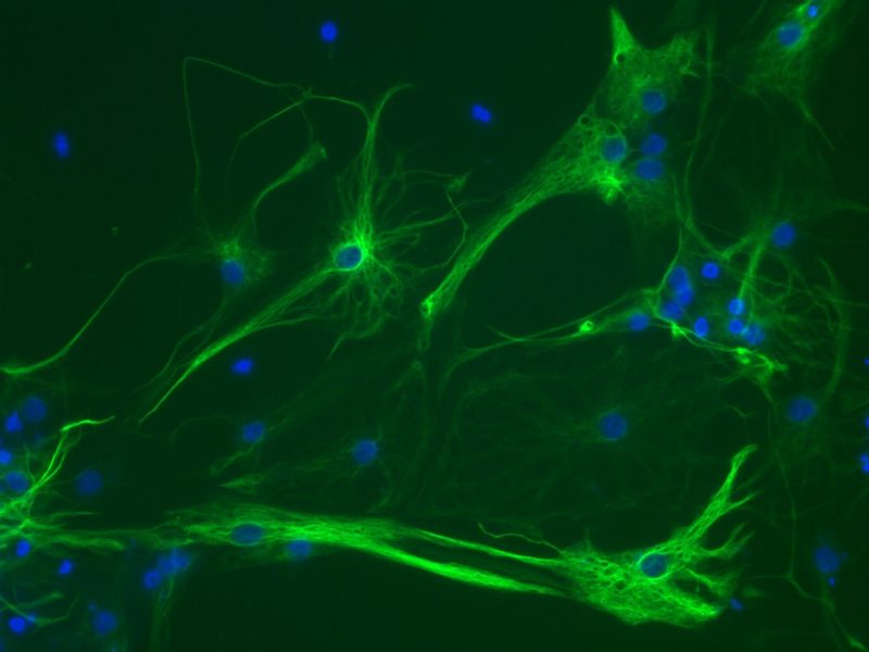 The Endocannabinoid System (ECS): Everything You Need To Know
