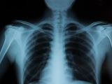 10 X Rays Uses In Everyday Life Studiousguy