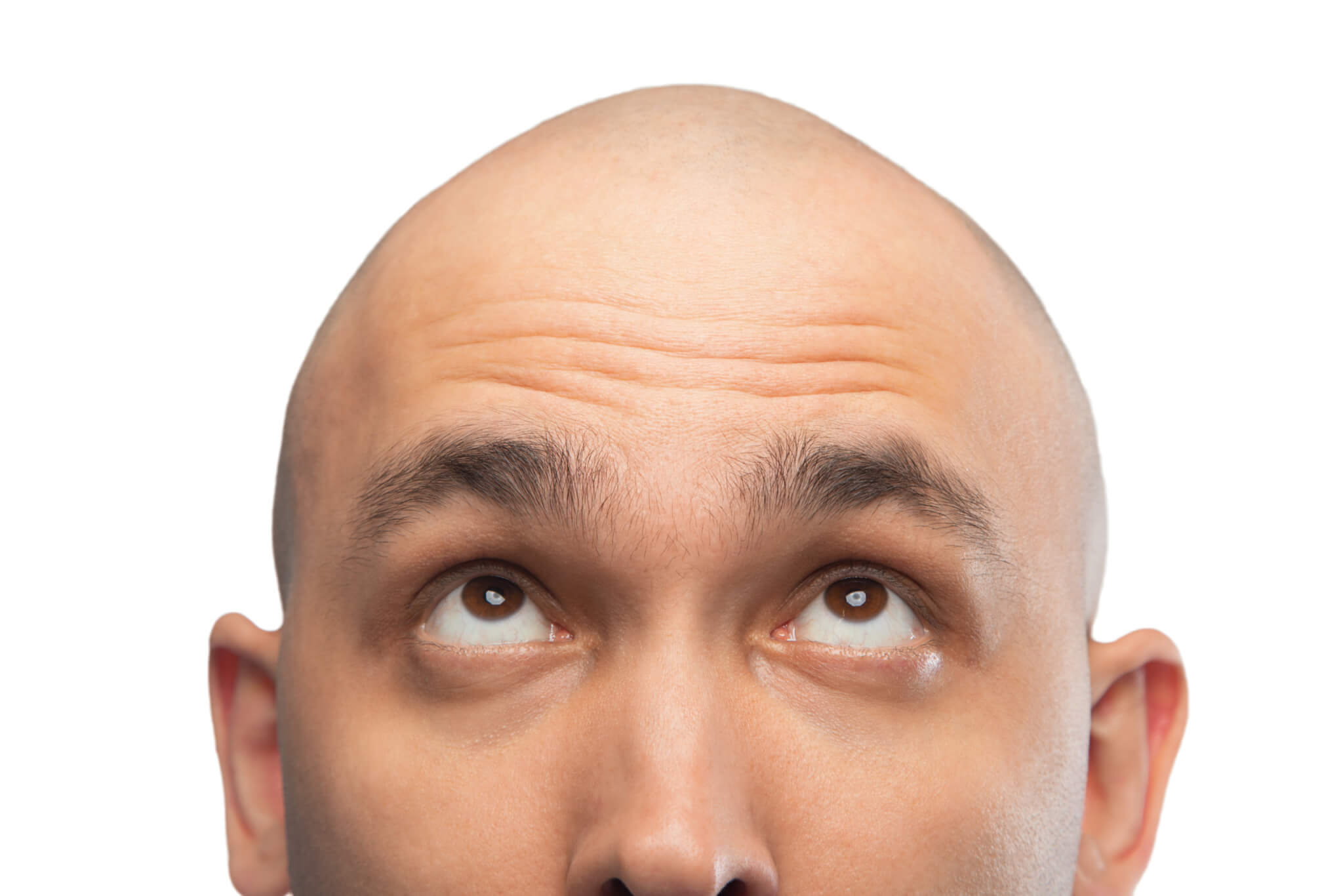 Baldness cure on horizon? Harvard scientists discover protein that ...