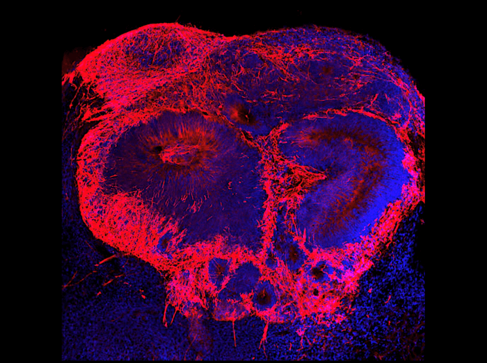 'Mini-brains' reveal genetic clues that schizophrenia develops in the womb