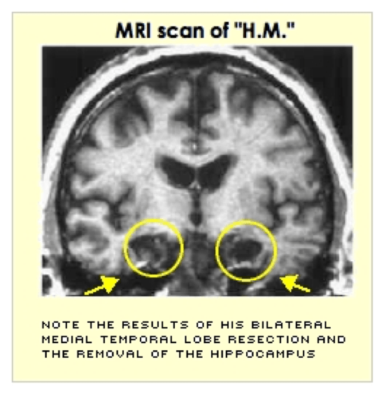 H.M. - Too Little Memory - Welcome to Stuff4Educators