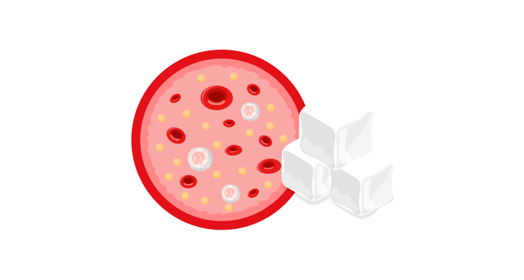 How Diabetes Develops Diabetes Hub
