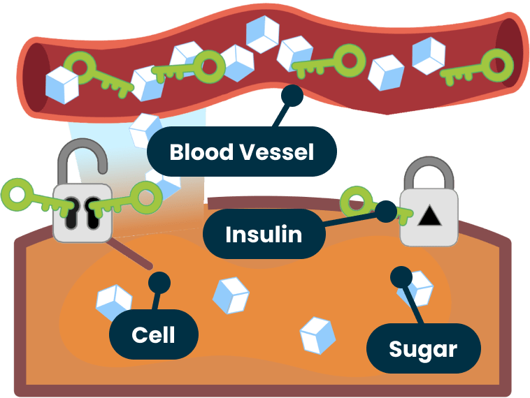 How Diabetes Develops Diabetes Hub
