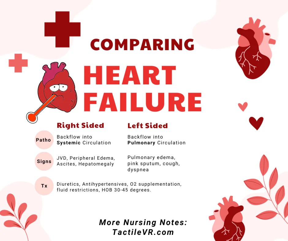 Mnemonic Left Sided Heart Failure Symptoms Arie Blitz Md Mba On X