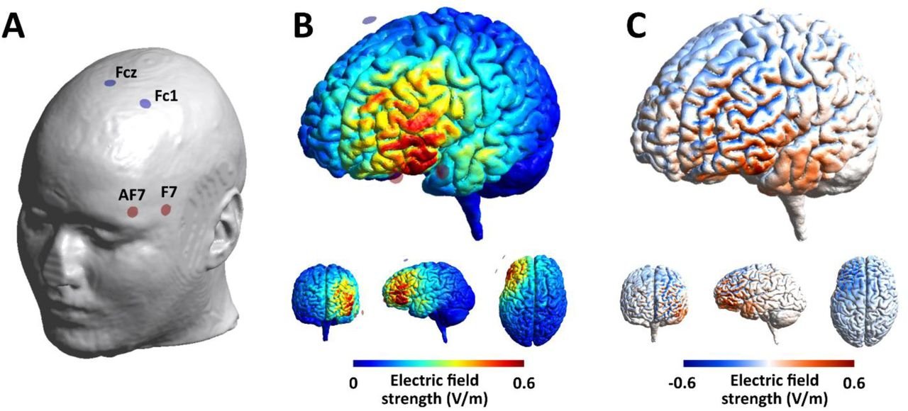 What to expect for tDCS in 2021 - tDCS.com