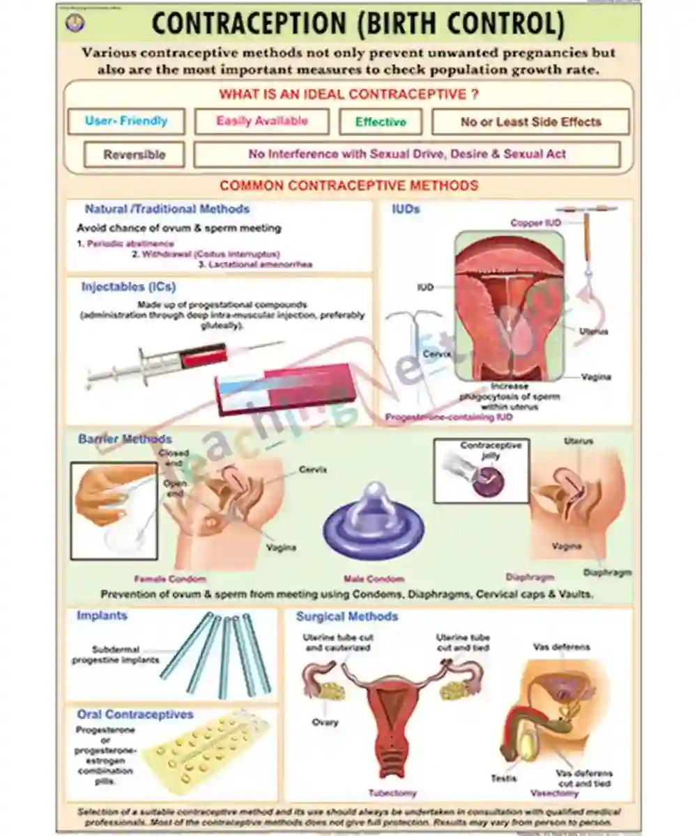 Contraception (Birth Control) Chart – Synthetic, Wall Sticking ...