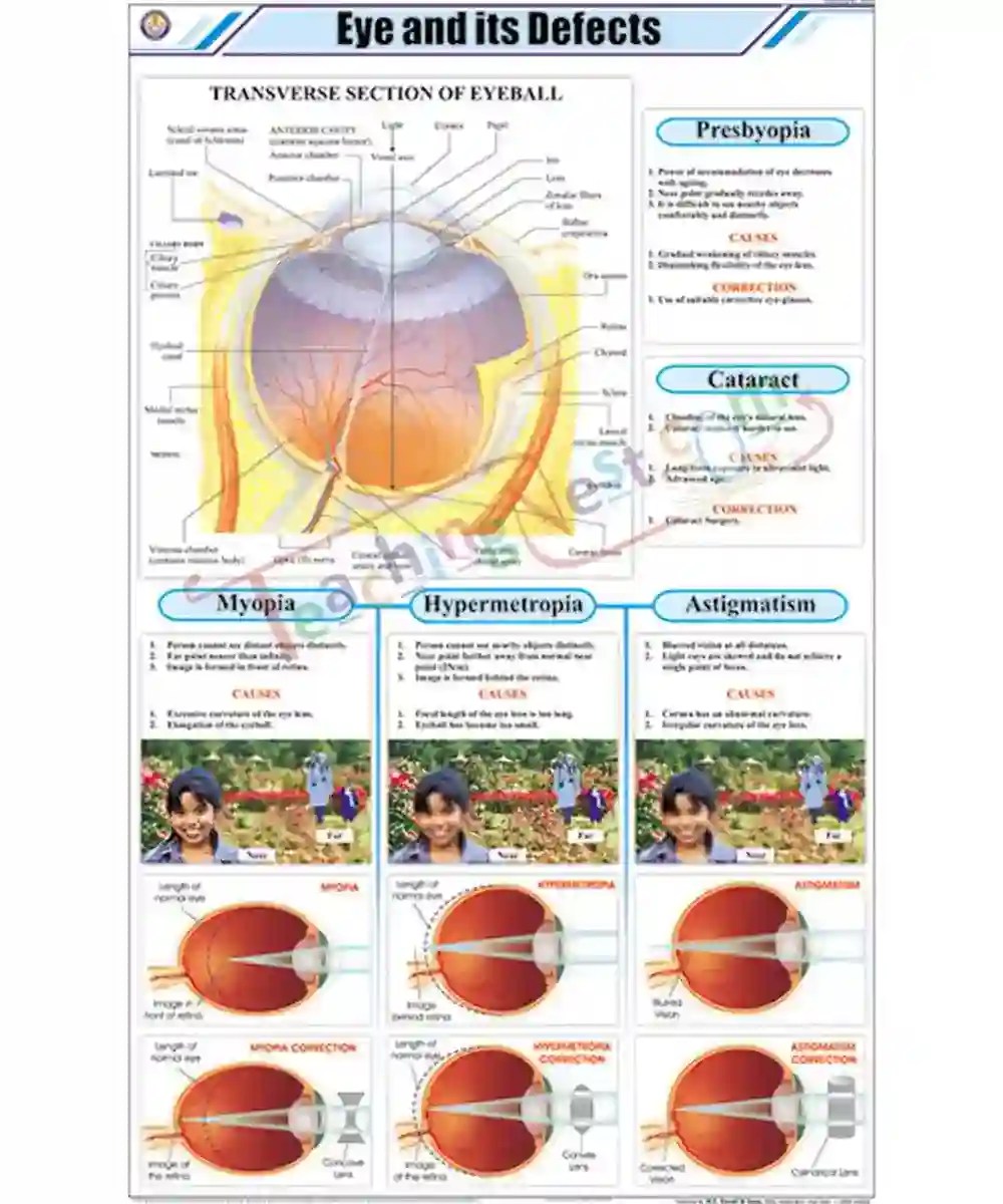 Eye and its Defects Chart – Laminated, With Rollers - TeachingNest