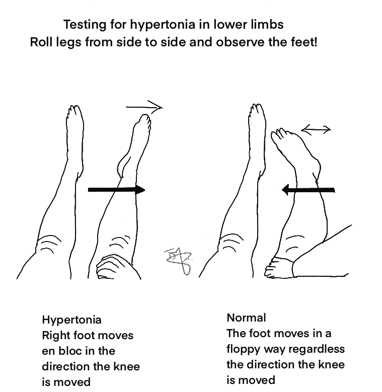 Neurologic Examination of the Limbs - The Med Book