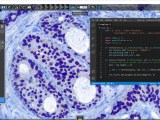3dhistech Releases Quantcenter邃 With Unique Image Analysis Module