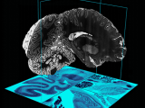 Brainbrowser Neurological Data Visualization Using Html5 And Webgl
