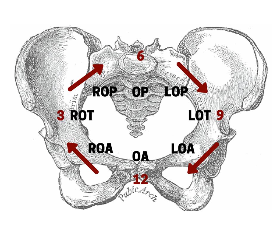 Does baby's position in labor matter? Part 2 of 2 - Tucson Doulas