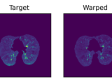 Nephi Neural Deformation Fields For Medical Image Registration
