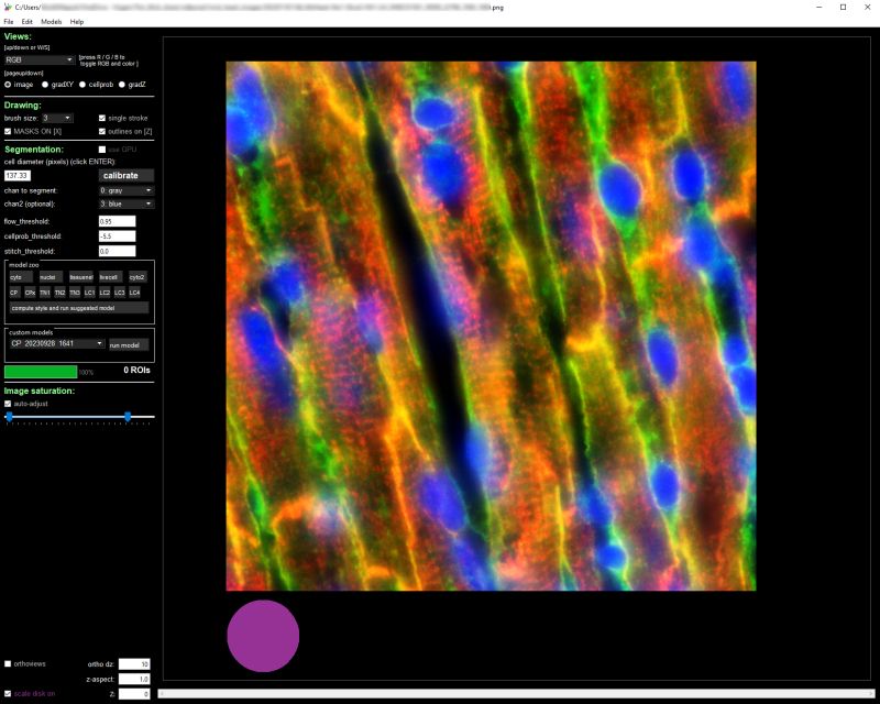 Example Re Segmenting A Merscope Heart Dataset With A Machine Learning - Premium Minimal Illustration Gallery - 8K