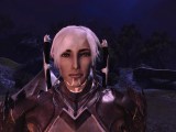 Fenris Dragon Age Desktop Wallpapers Wallpaper Cave