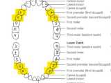 Bicuspid Teeth Everything You Need To Know Web Dmd