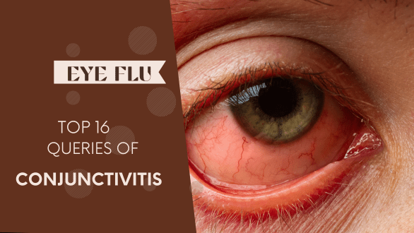 Curious About Eye Flu? Unveiling The Top 16 Queries Of Conjunctivitis ...