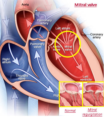 Mitral Valve Disease in Dogs - Write of the Middle