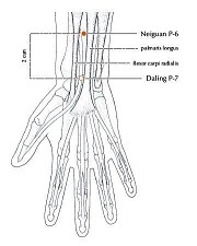 Acupuncture – Vitality Holistic Health centre