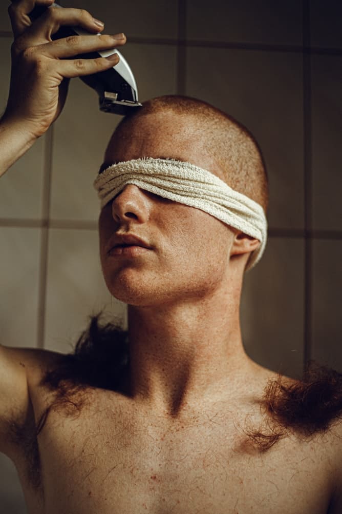 how-to-cure-baldness-az-world-news